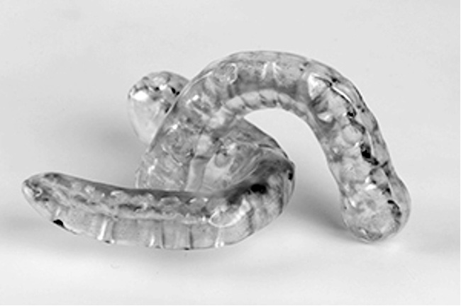 Bite Raising Appliance – GoDigital Dental