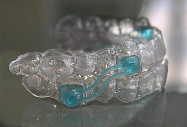 Silensor Anti-Snoring Devices – GoDigital Dental
