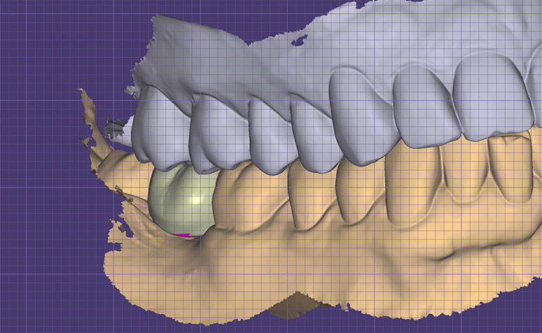 Inside a Modern Dental Lab: Technology, Art & Precision