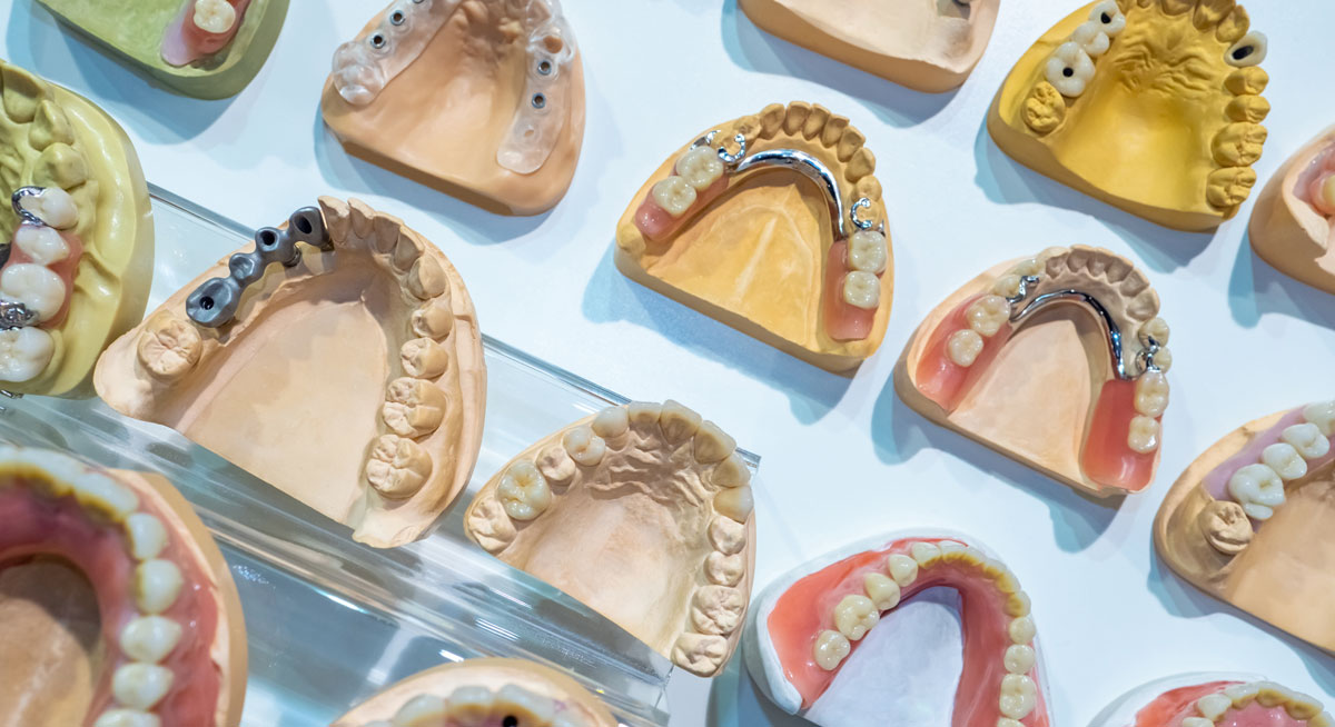 Choosing the Right Digital Dental Lab Partner - GoDigital Dental